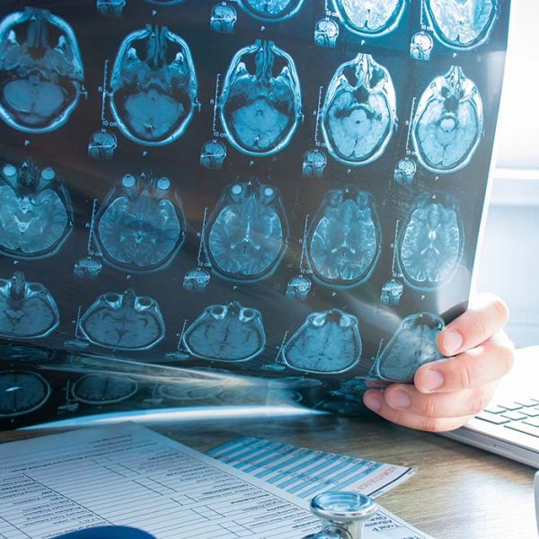 News - Epilepsy Action